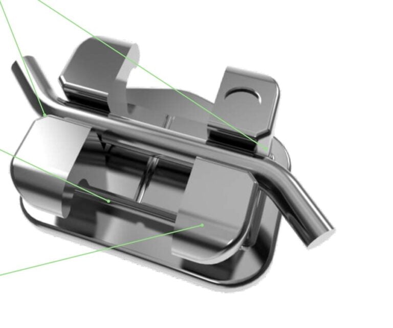Kit Bracket Surpass Monoblock 022 - Alldental